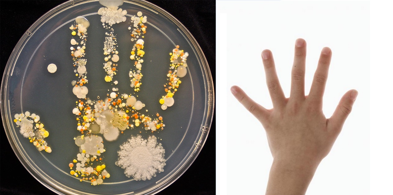 Here’s What Happens When Bacteria are Cultured on an Eight-Year-Hand ...