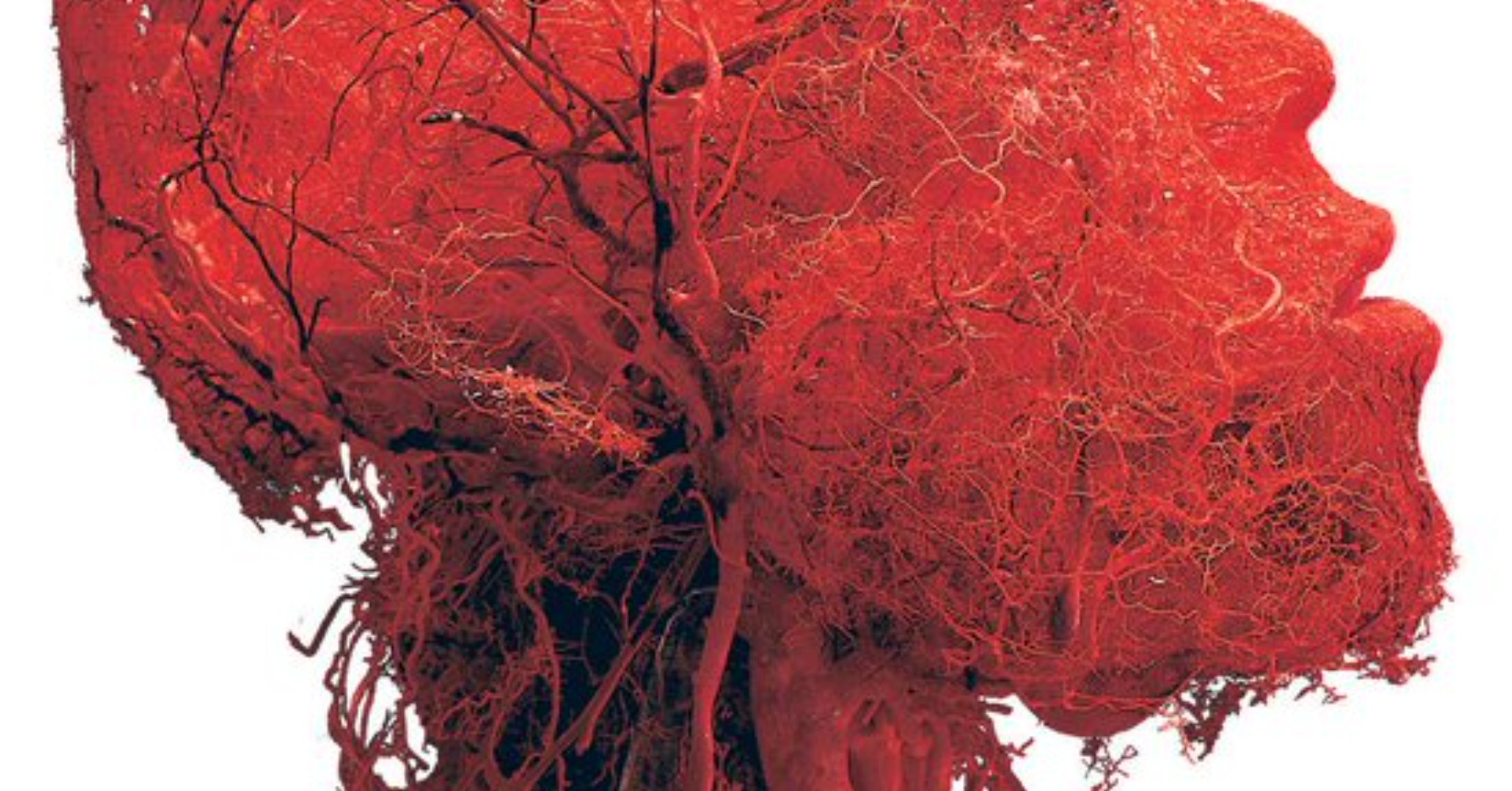 The Plastinated Specimen of the Blood Vessels of the Head and the Brain ...
