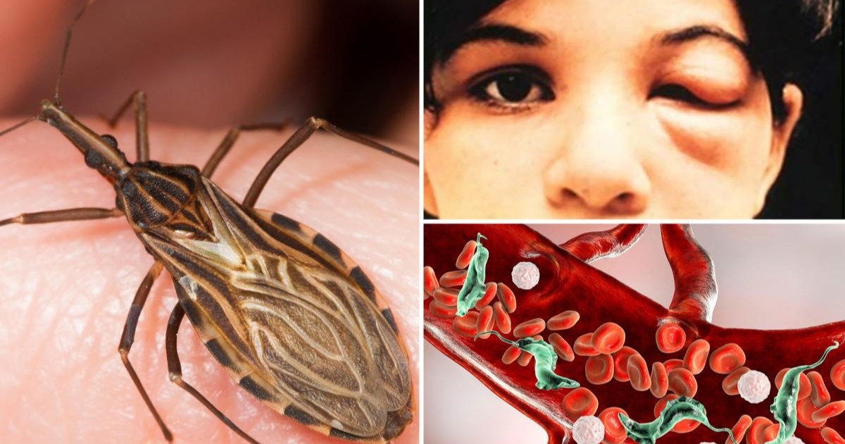 These bugs come out at nighttime, and attacking victims, they silently ...