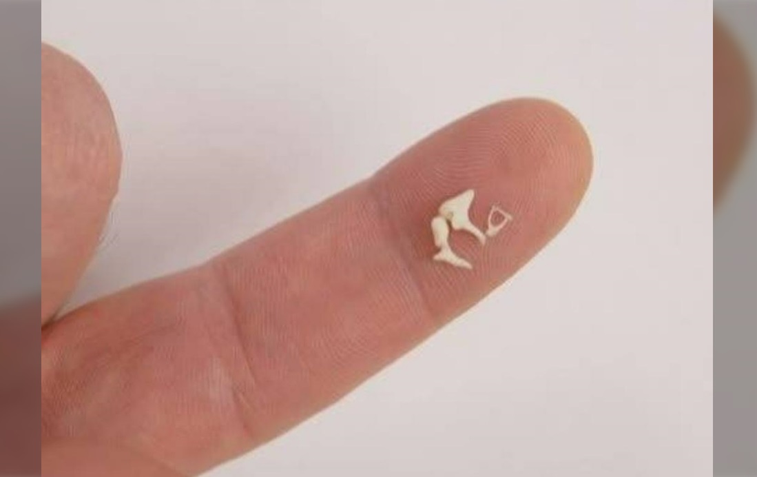 These are the three smallest bones in the human body - Hasan Jasim