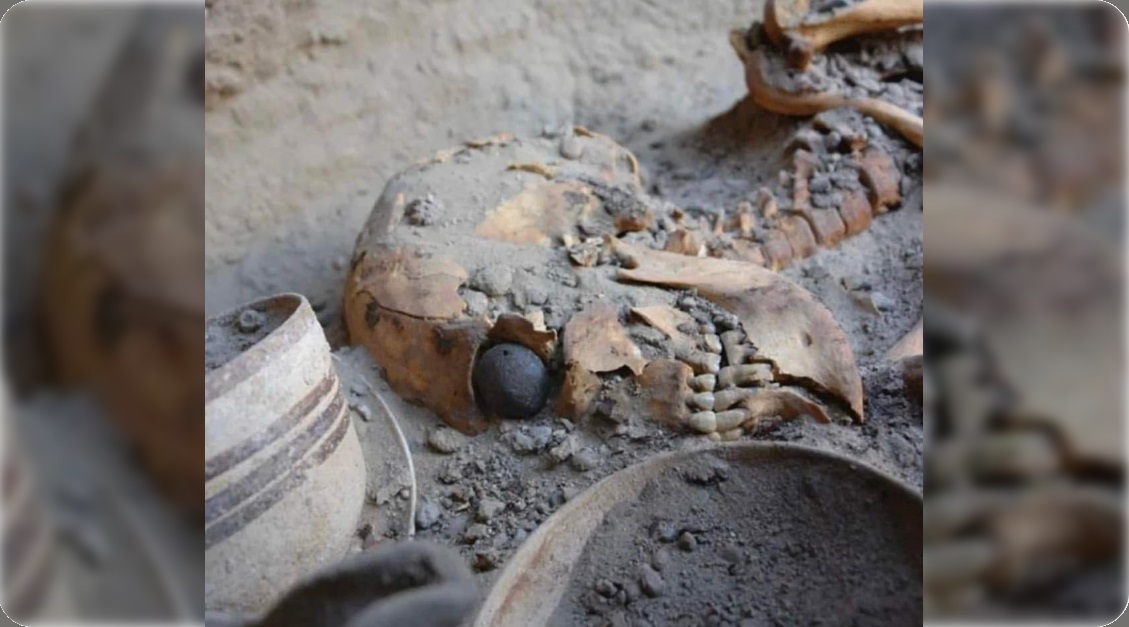 Ancient Eye: World’s Oldest Artificial Eyeball Discovered in Iran ...