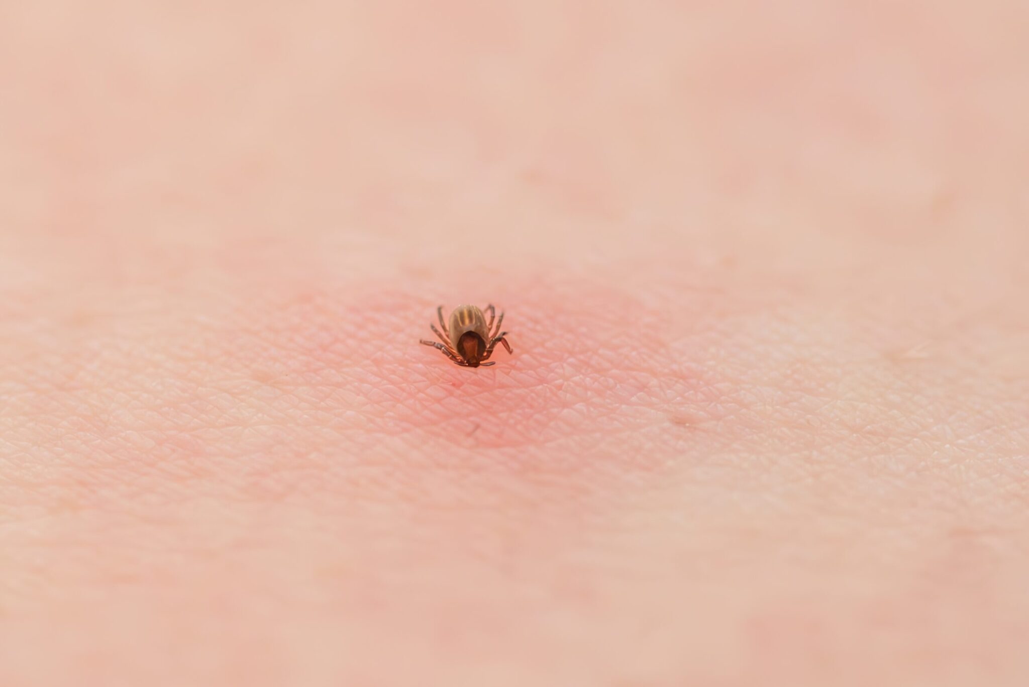 How to properly dispose of ticks if you find one - Hasan Jasim